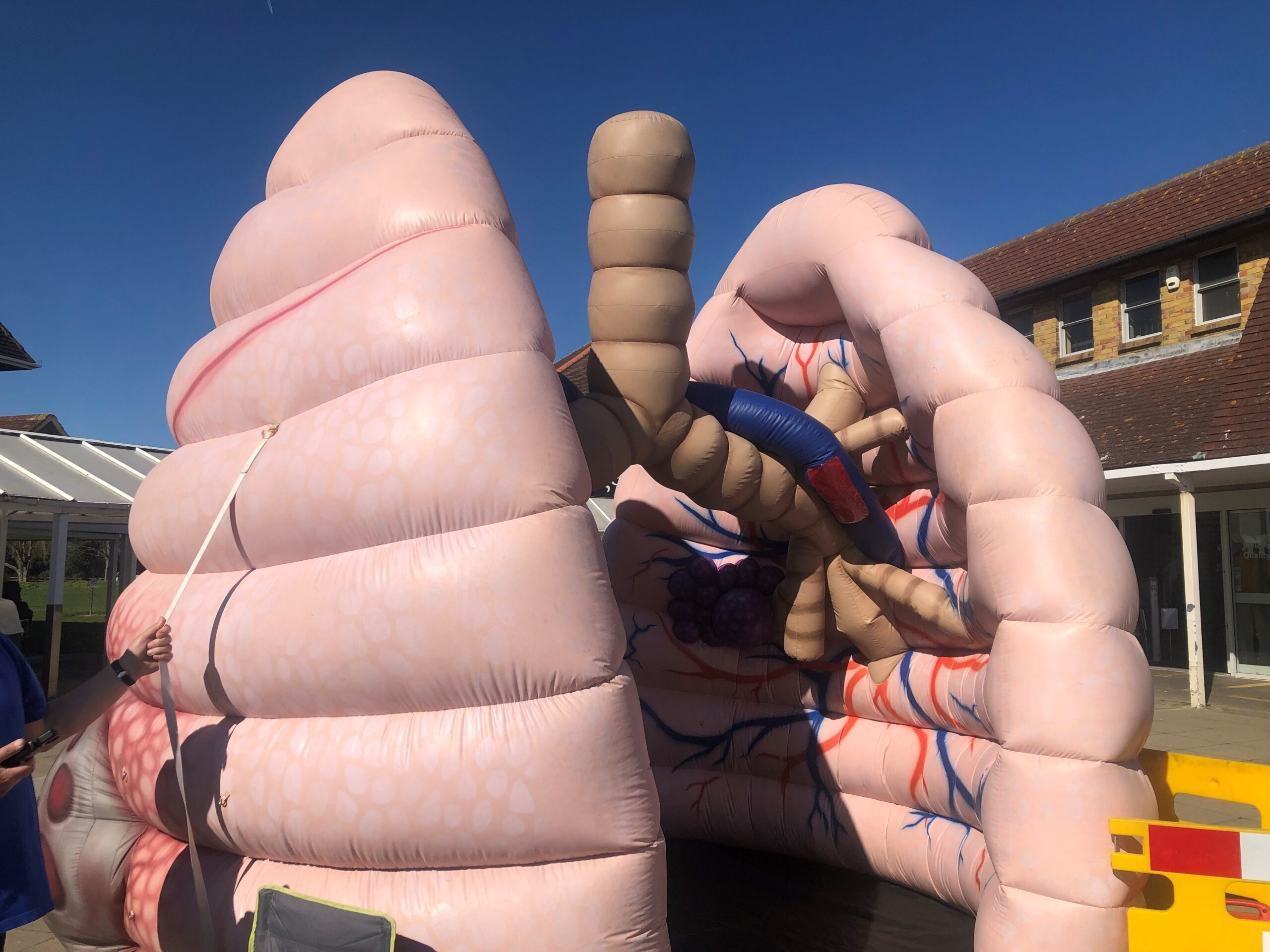 Giant inflatable lungs coming to Basildon - Mid and South Essex ...